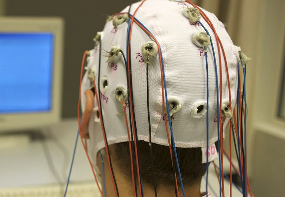 CoxHealth | Neurodiagnostics